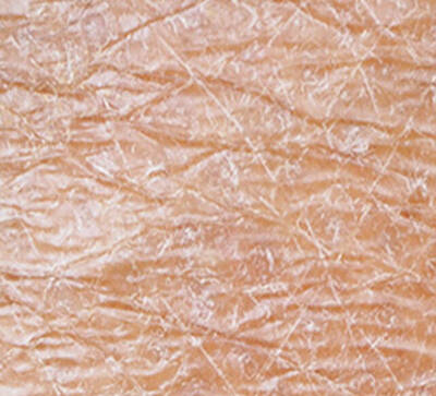 Gedehydrateerde vs. droge huid: Wat is het verschil? | SkinCeuticals